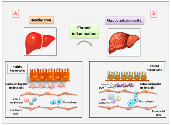 JCM | Free Full-Text | Immune and Non-Immune Inflammatory Cells Involved in Autoimmune Fibrosis ...