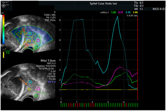 JCM | Free Full-Text | Predicting Preterm Birth with Strain Ratio ...