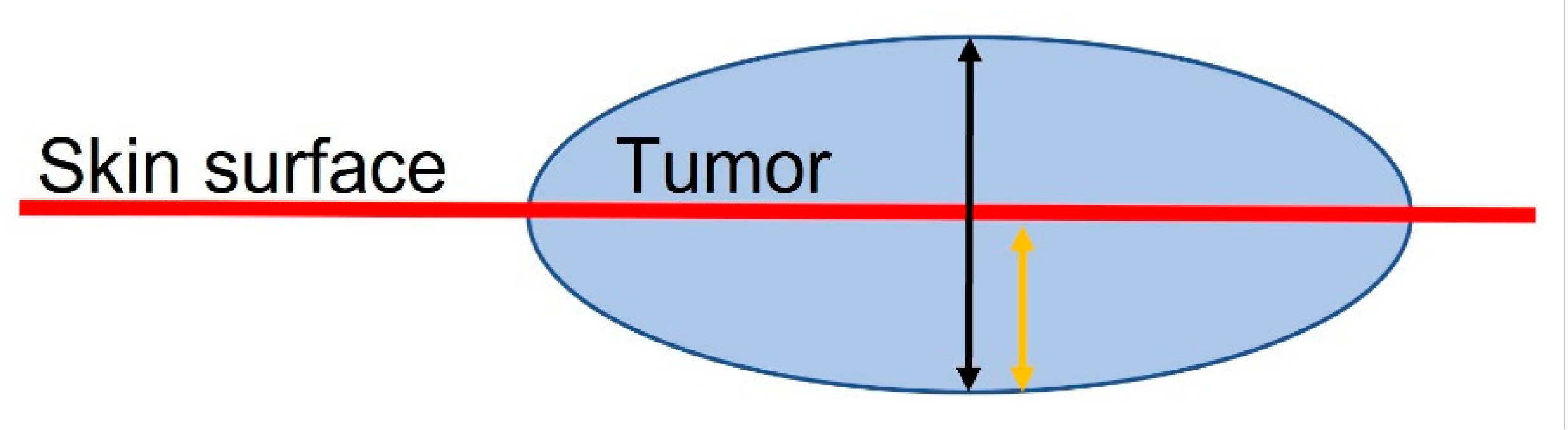 High Frequency Ultrasound of Basal Cell Carcinomas: Ultrasonographic ...