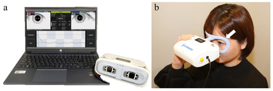 Detection of Relative Afferent Pupillary Defect and Its Correlation with Structural and ...