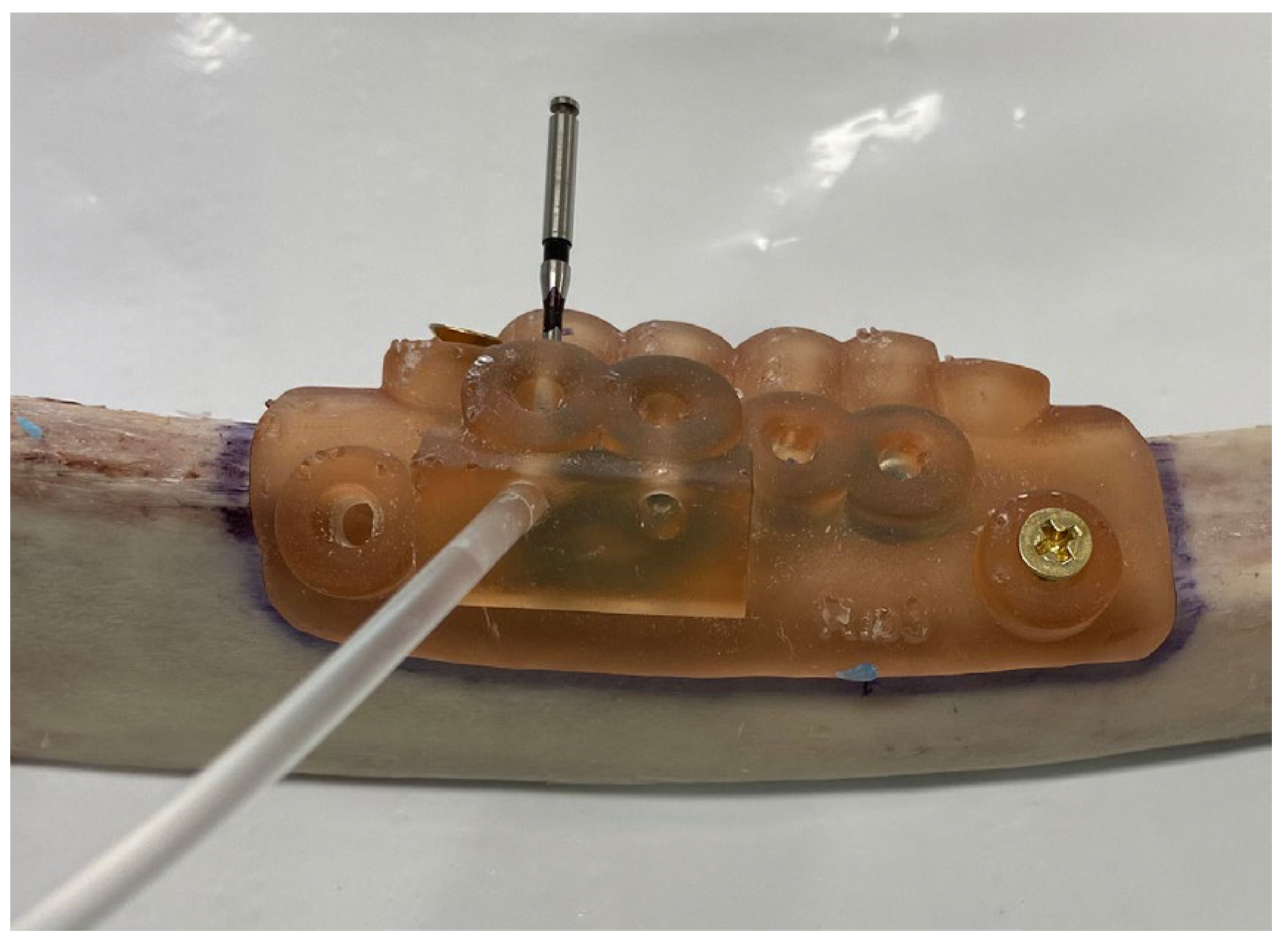 A Novel Irrigation System to Reduce Heat Generation during Guided ...