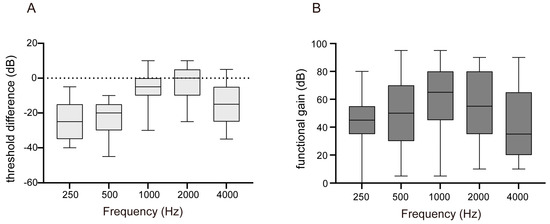 JCM | Free Full-Text | Hearing Outcome and Predictors after Implanting ...