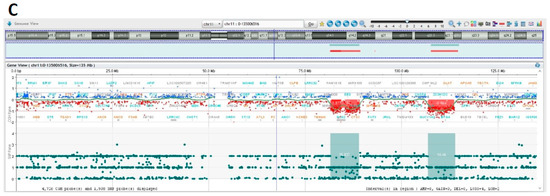 A Peculiar CLL Case with Complex Chromosome 6 Rearrangements and ...