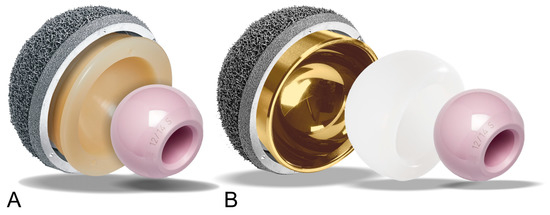Is Modular Dual Mobility Superior to Standard Bearings for Reducing ...