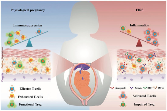 Inflammation and Immune Reactions in the Fetus as a Response to COVID ...