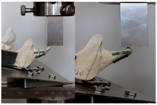 Evaluation of the Relationship of Screw Pullout and Plate Fracutre in ...