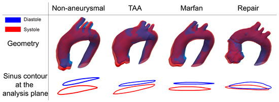 Three-Dimensional Characterization of Aortic Root Motion by Vascular ...