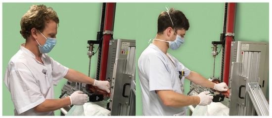 Objective Assessment of Syndesmosis Stability Using the Hook Test