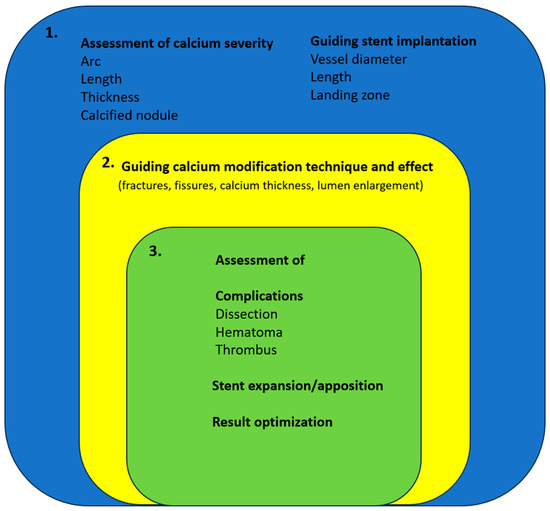 JCM | Free Full-Text | The Role of Intracoronary Imaging for the ...