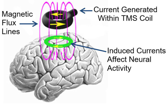 JCM | Free Full-Text | Unresolved Issues Associated with Transcranial Magnetic Stimulation (TMS ...