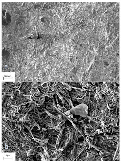 Skin Bank Establishment in Treatment of Severe Burn Injuries: Overview ...