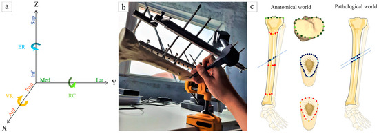 An Easy-To-Use External Fixator for All Hostile Environments, from ...
