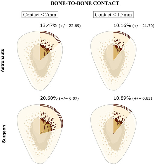 An Easy-To-Use External Fixator for All Hostile Environments, from ...