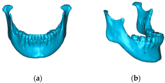 JCM | Free Full-Text | Relationship between Changes in Condylar ...