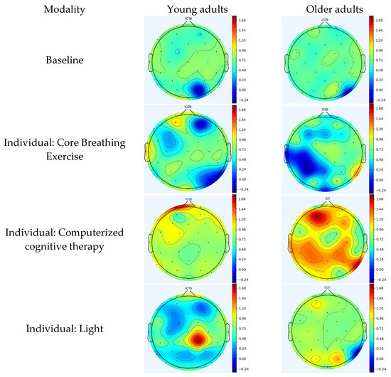 The Effectiveness of a Multimodal Brain Empowerment Program in Mild Cognitive Impairment: A ...