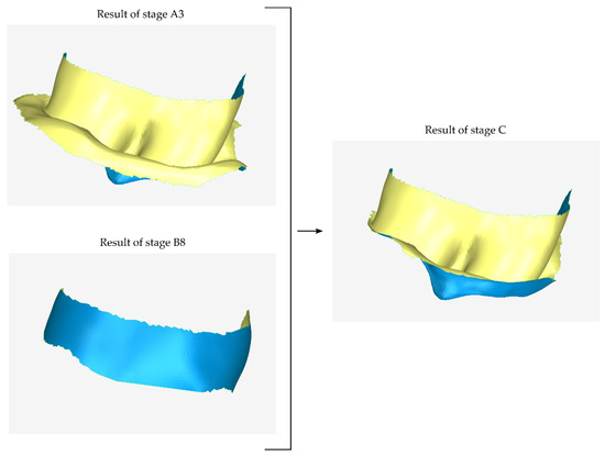 CBCT-Based Design of Patient-Specific 3D Bone Grafts for Periodontal ...