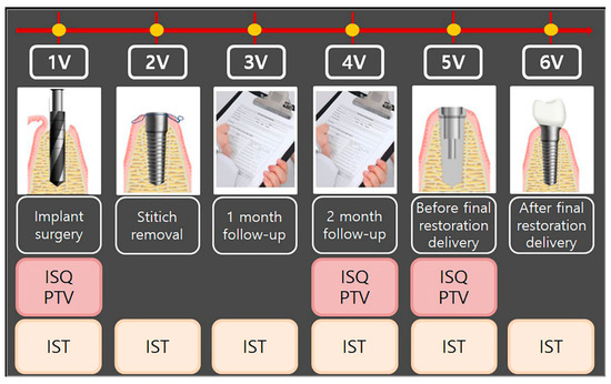 Evaluation of Implant Stability According to Implant Placement Site and ...