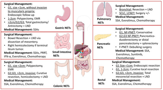 A Comprehensive Review on Neuroendocrine Neoplasms: Presentation ...
