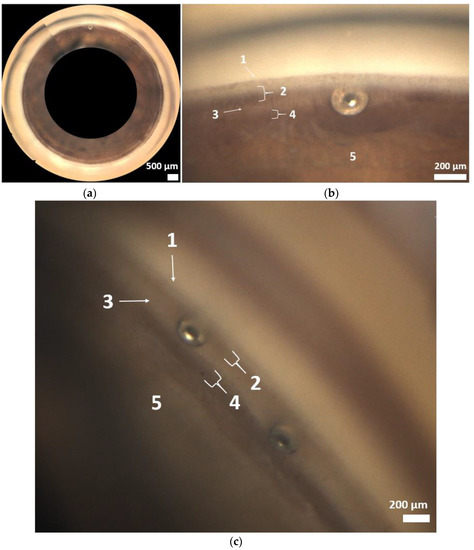 Position of the ISTENT Inject® Trabecular Micro-Bypass System Visualized with the NIDEK GS-1 ...