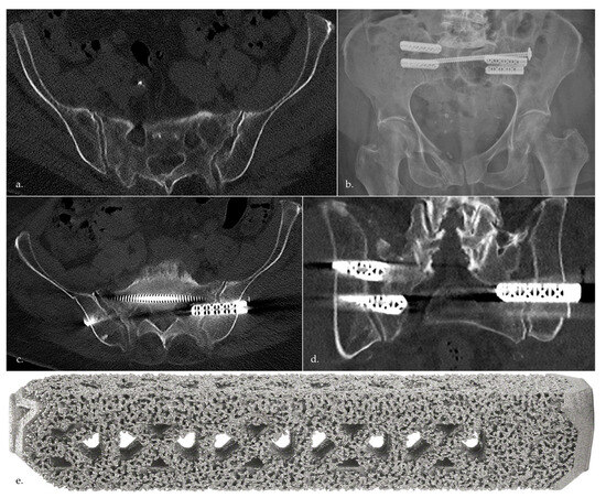Evaluation of a New Treatment Strategy for Geriatric Fragility ...