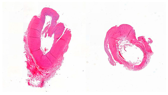 JCM | Free Full-Text | Risk Factors for Flap Loss: Analysis of Donor ...