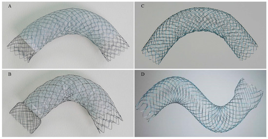 Second Covered and Uncovered Self-Expandable Metal Stents for Recurrent Gastric Outlet ...