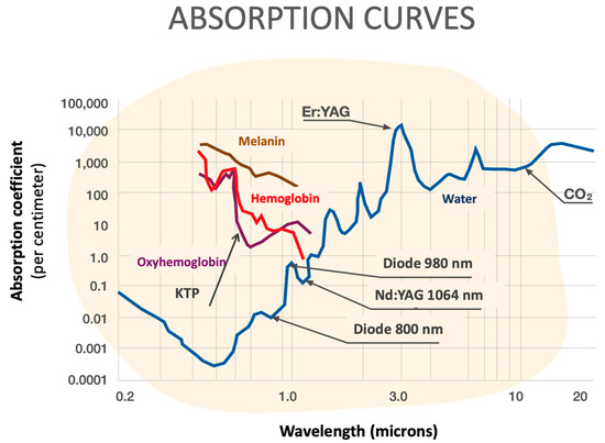 Transoral Flexible Laser Surgery of the Larynx with Blue Laser