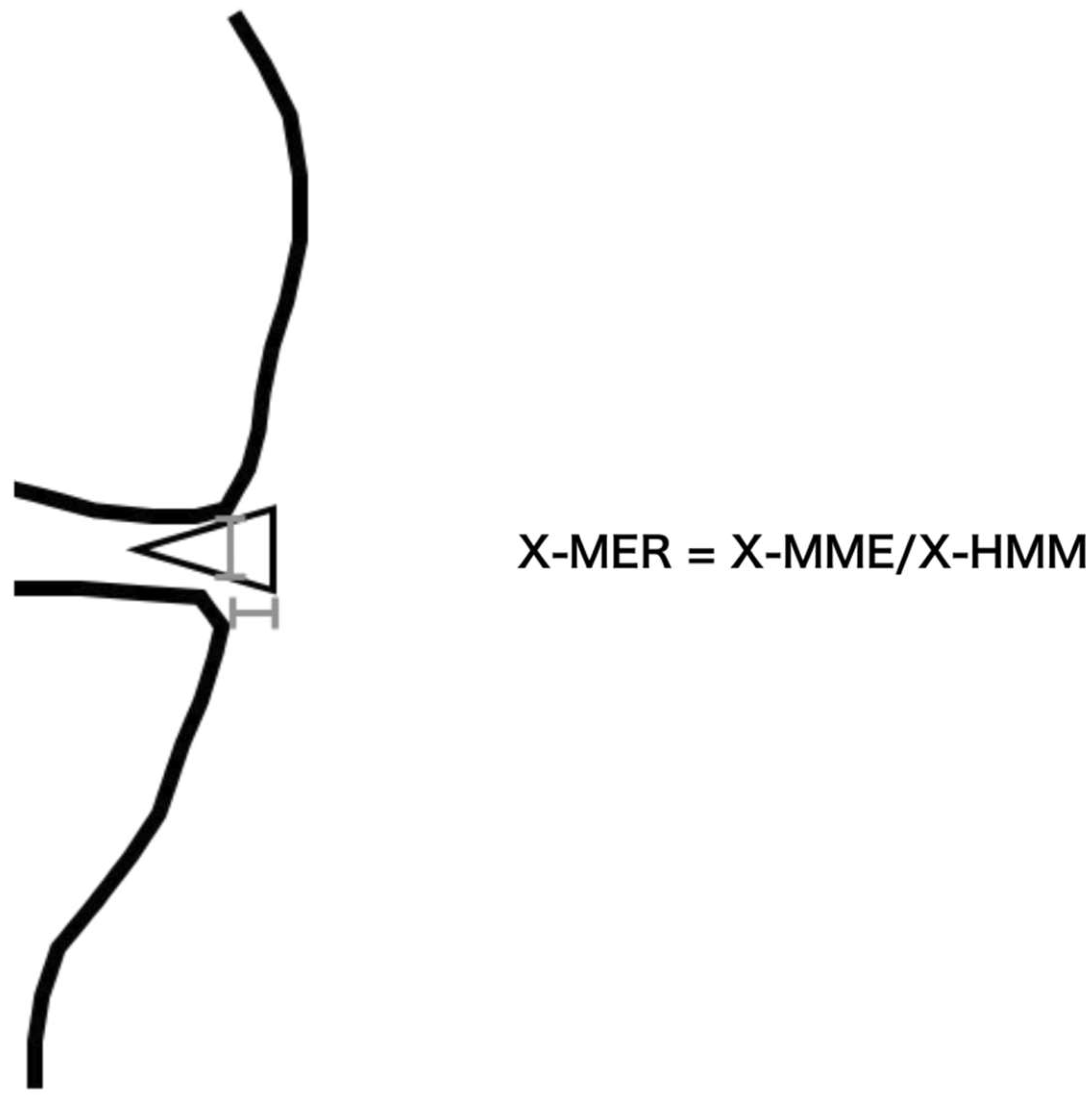 Evaluation of Medial Meniscal Extrusion Using Radiography