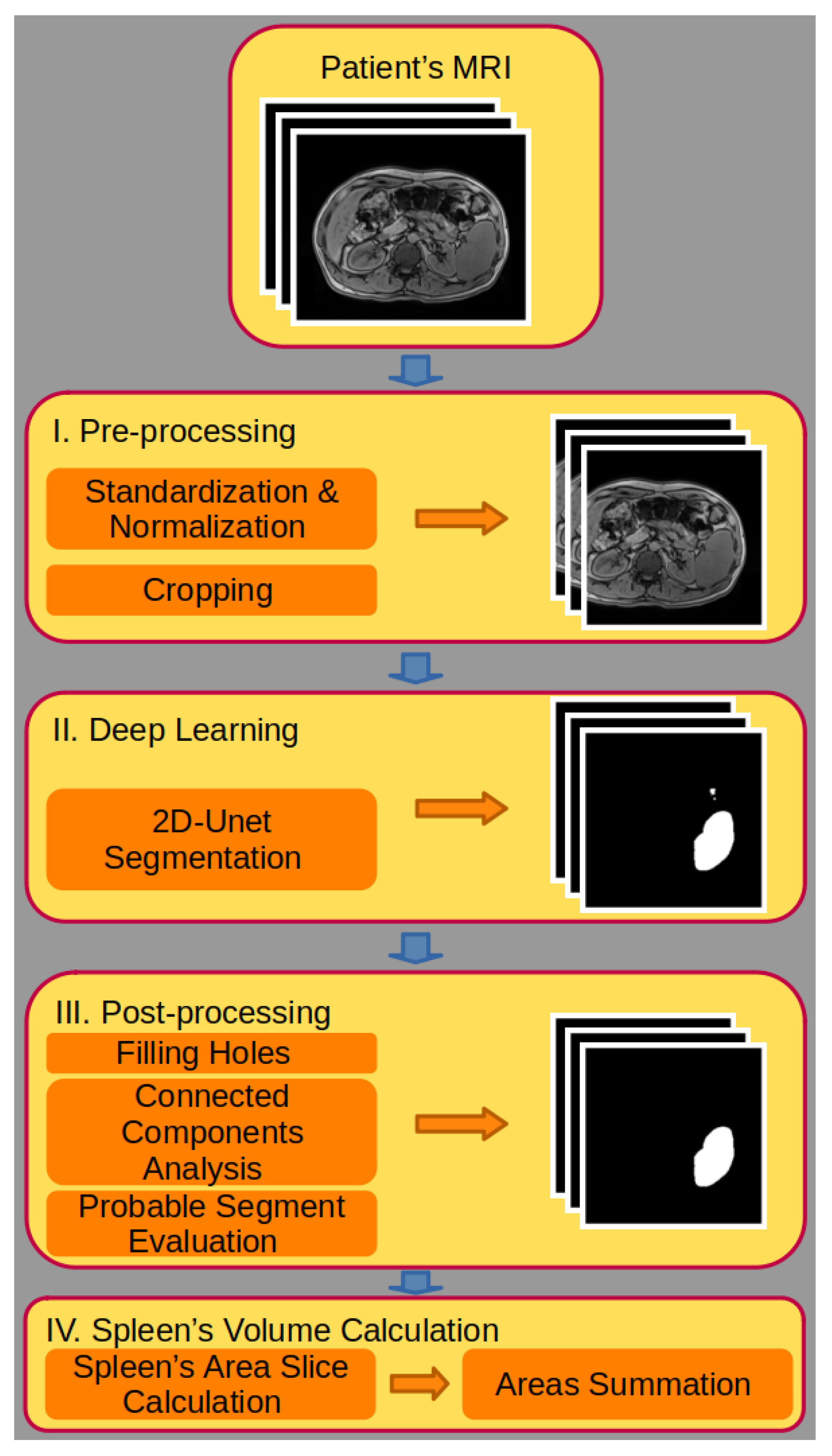A Deep-Learning Approach to Spleen Volume Estimation in Patients with Gaucher Disease