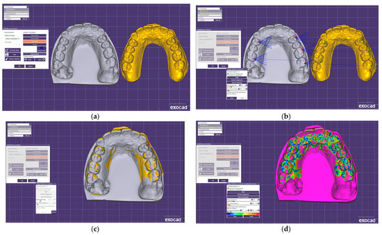 Evaluation of Intraoral Full-Arch Scan versus Conventional Preliminary ...