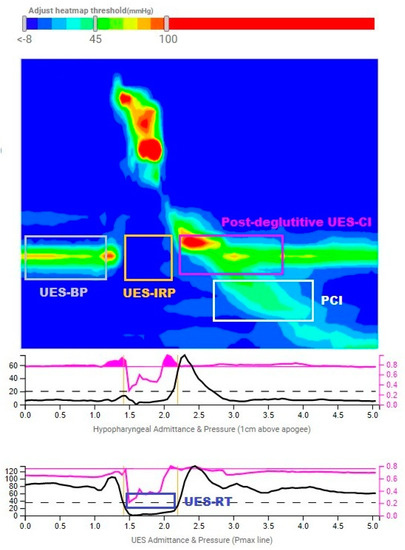 Upper Esophageal Sphincter Metrics across Eosinophilic Esophagitis ...