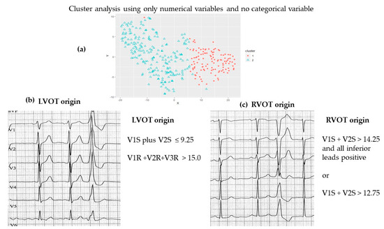 JCM | Free Full-Text | Identifying Premature Ventricular Complexes from ...