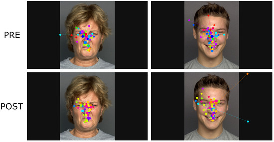 Effects of Transcranial Direct Current Stimulation on Social Attention ...