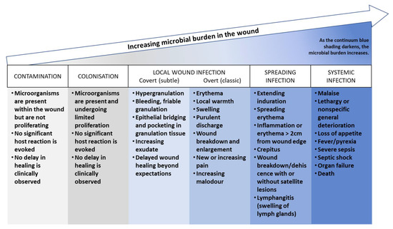 JCM | Free Full-Text | Evolution of the Chronic Venous Leg Ulcer ...