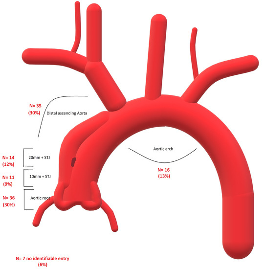 Feasibility of Total Endovascular Repair of the Aorta in Patients with ...