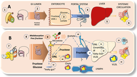 Sugar and Dyslipidemia: A Double-Hit, Perfect Storm