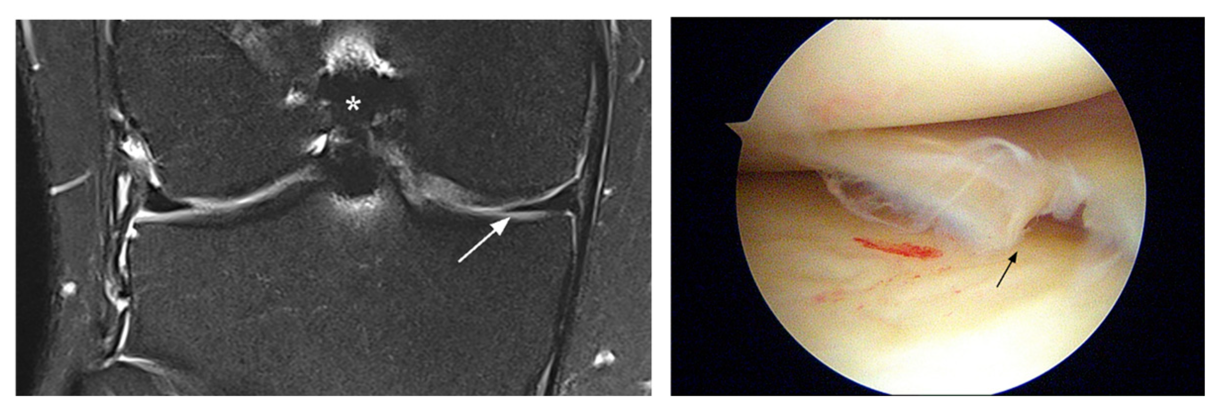 Analysis of Discordant Findings between 3T Magnetic Resonance Imaging ...