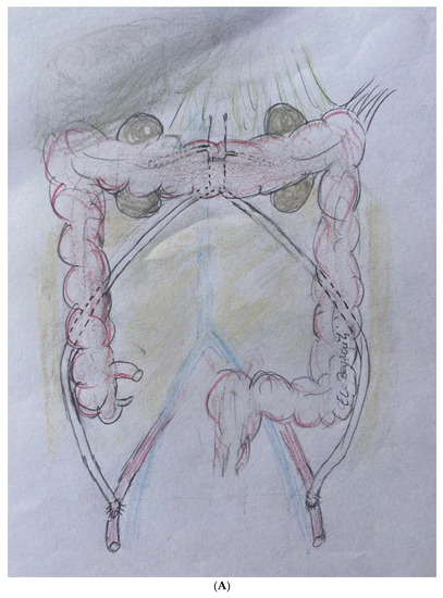 JCM | Free Full-Text | Paracolic Gutter Routing: A Novel ...