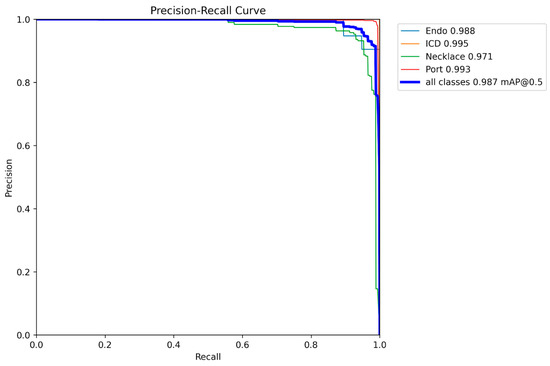 Chest X-ray Foreign Objects Detection Using Artificial Intelligence
