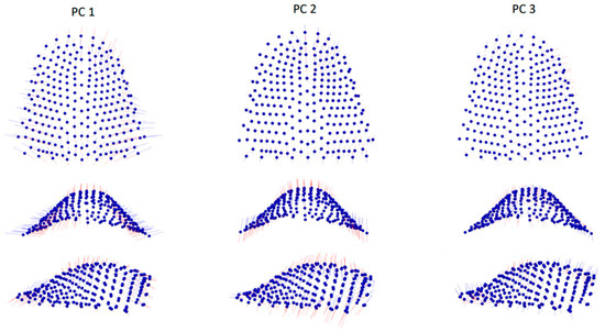 The Slavcleft: A Three-Center Study of the Outcome of Treatment of ...
