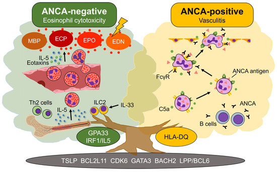 Eosinophilic Granulomatosis with Polyangiitis: Latest Findings and ...