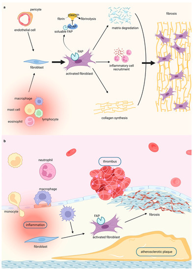 Highlighting Fibroblasts Activation in Fibrosis: The State-of-The-Art ...