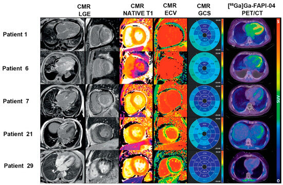 JCM | Free Full-Text | Highlighting Fibroblasts Activation in Fibrosis ...