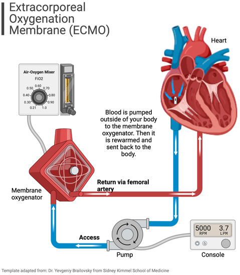 Growing Evidence for LV Unloading in VA ECMO