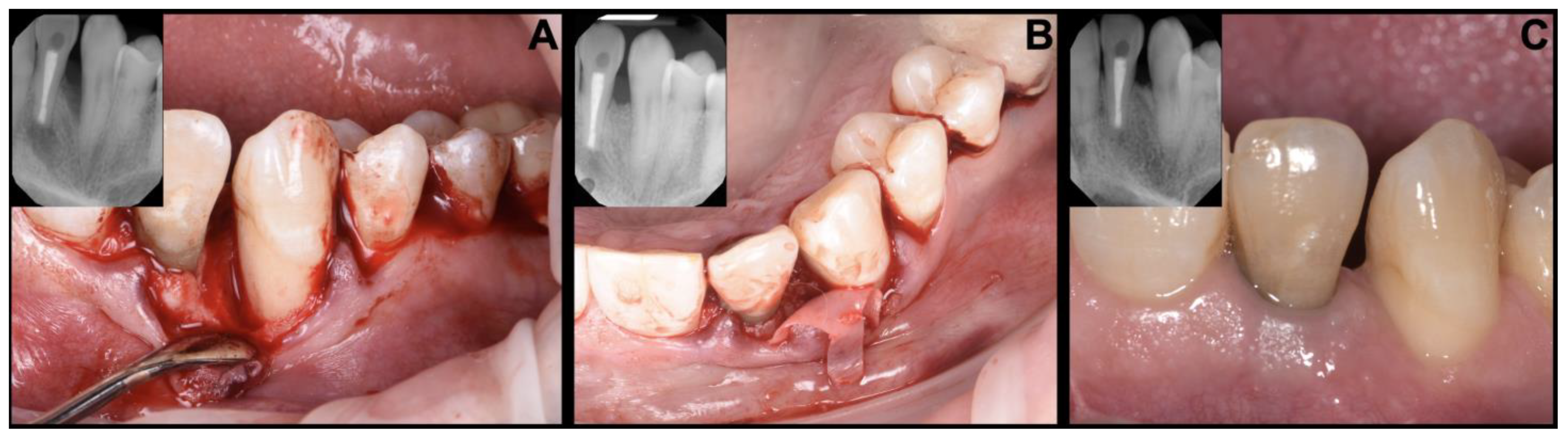 JCM | Free Full-Text | A Modern Approach to Treat Molar/Incisor Pattern ...