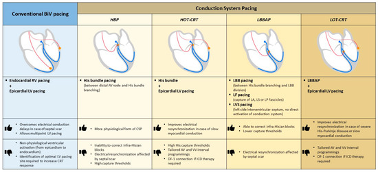 Conduction System Pacing versus Conventional Biventricular Pacing for ...