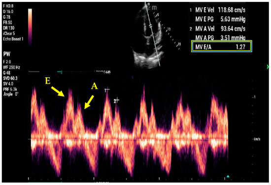 JCM | Free Full-Text | Objective Methods of Assessing Fluid Status to ...