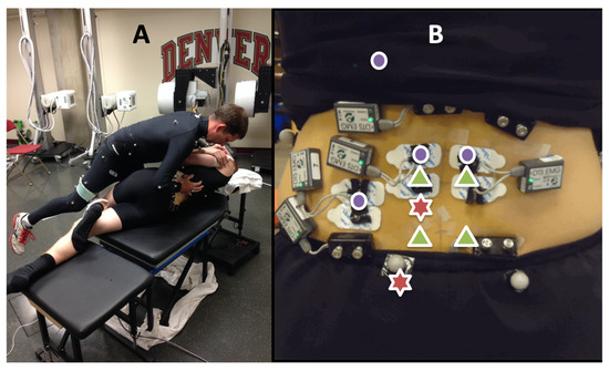 Treatment and Response Factors in Muscle Activation during Spinal ...