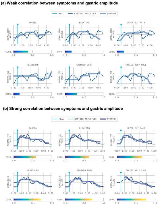Gastric Alimetry® Test Interpretation in Gastroduodenal Disorders ...