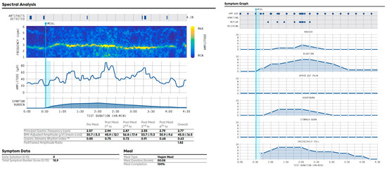 Gastric Alimetry® Test Interpretation in Gastroduodenal Disorders ...